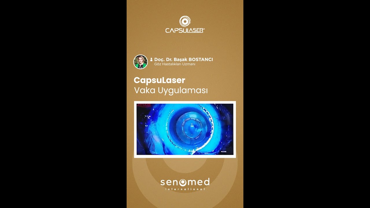 CapsuLaser Vaka Uygulaması - YouTube