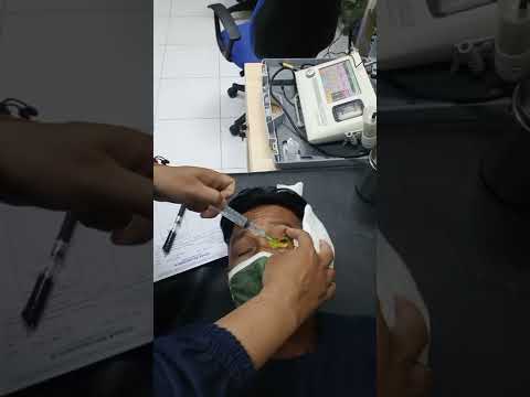 cuci mata Klinik Utama Sagara Eye Care