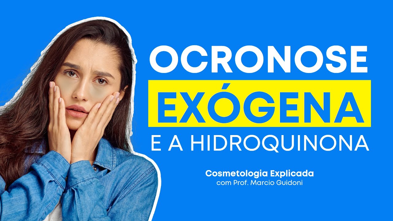 POR QUE A HIDROQUINONA CAUSA OCRONOSE EXÓGENA I Cosmetologia Explicada ...