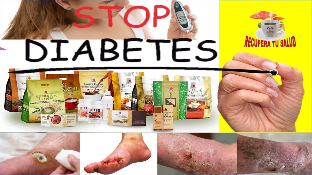 "Solución natural para la Diabetes con una inversión segura: Recupera ...