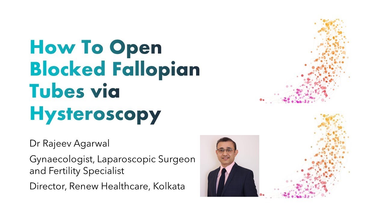 How To Open Blocked Fallopian Tubes via Hysteroscopy - YouTube