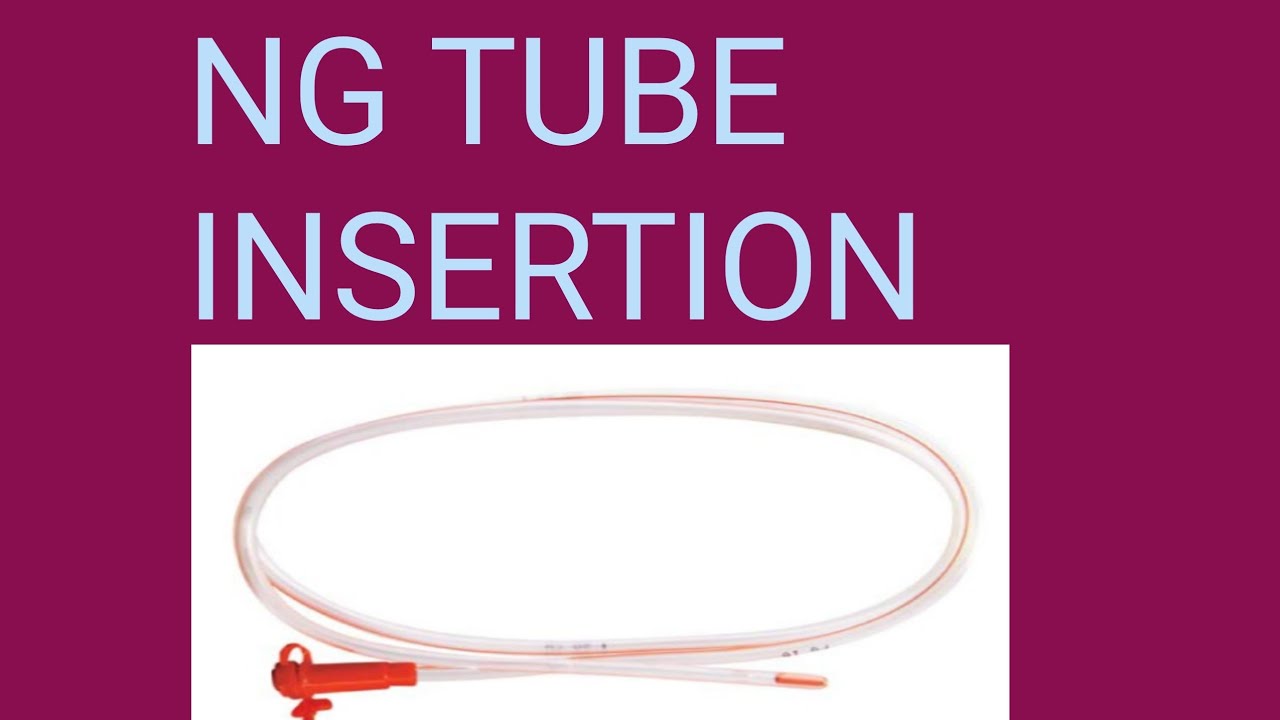 What Are The Complications Of Nasogastric Tube at Jerry Bergman blog