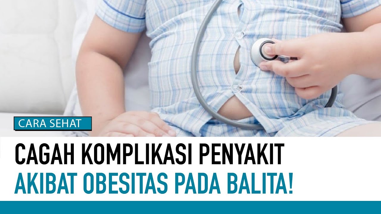 Waspada Obesitas Pada Balita! Ini Cara Pencegahannya | Cara Sehat - YouTube