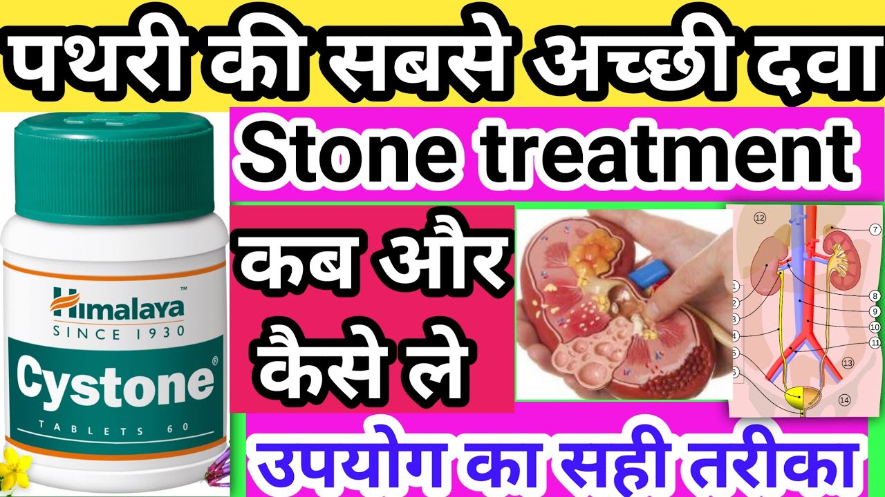 cystone tablet ke fayde | Himalaya cystone tablet | cystone tablet uses ...