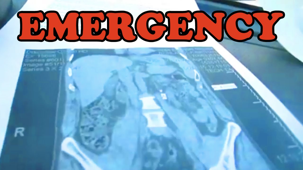 EMERGENCY ROOM VISIT | while they were napping - YouTube