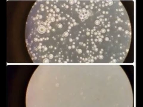 Microscope VIEW of BREAST FED MILK VS FORMULA MILK our babies deserve ...