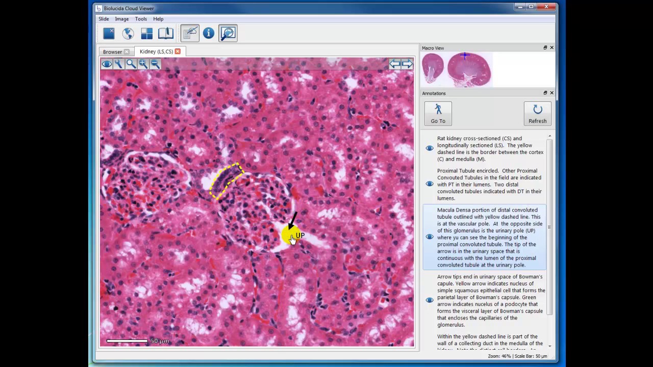 Module 4 Kidney - YouTube