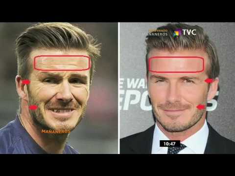 Top Ten: Famosos que han cambiado por el uso de botox - YouTube