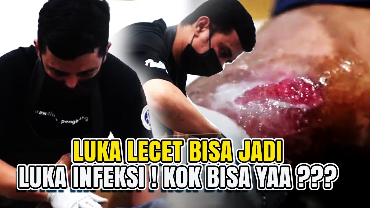 LUKA LECET BISA JADI LUKA INFEKSI KOK BISA YAA PERAWATAN LUKA LECET ...