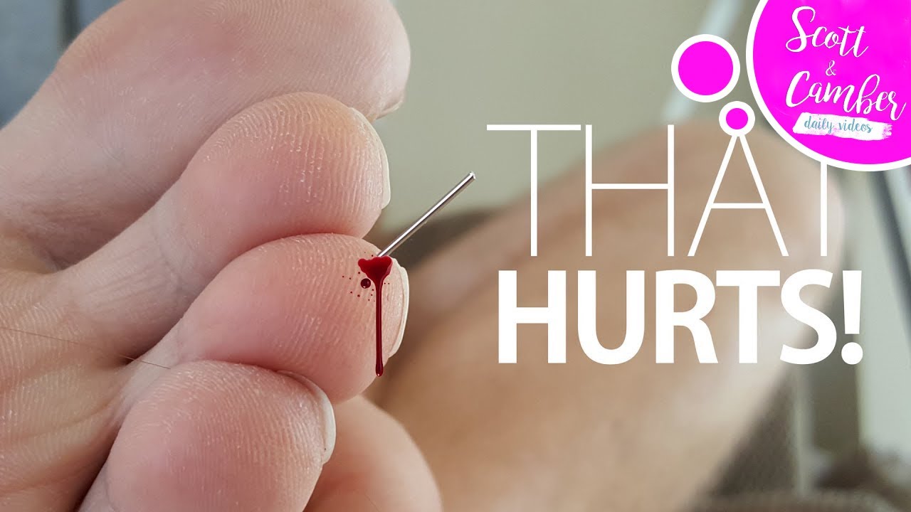 FOOT INJURY! I STEPPED ON SOMETHING... - YouTube