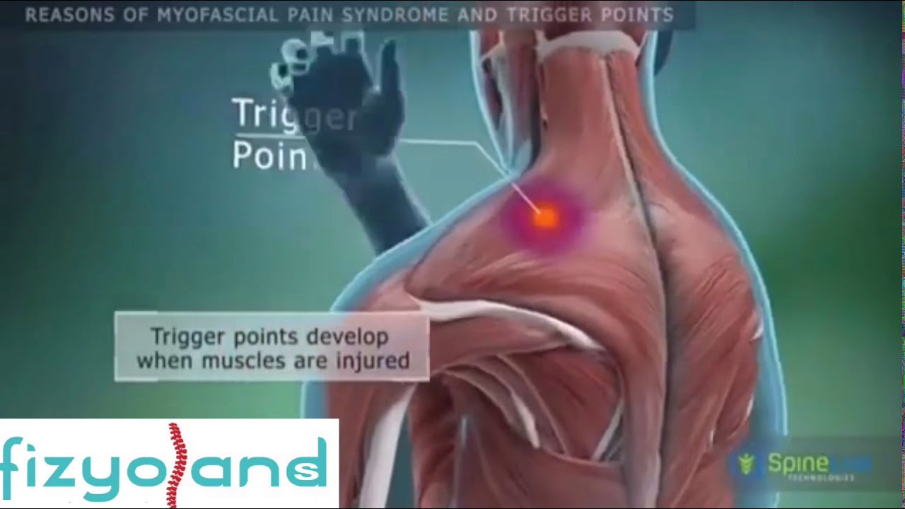 Trigger Point ( Tetik Nokta ) - YouTube