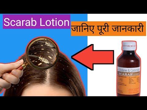 Scarab Lotion ।।Kaise Lagaye।। जानिए पूरी जानकारी हिंदी में।।scabies ...