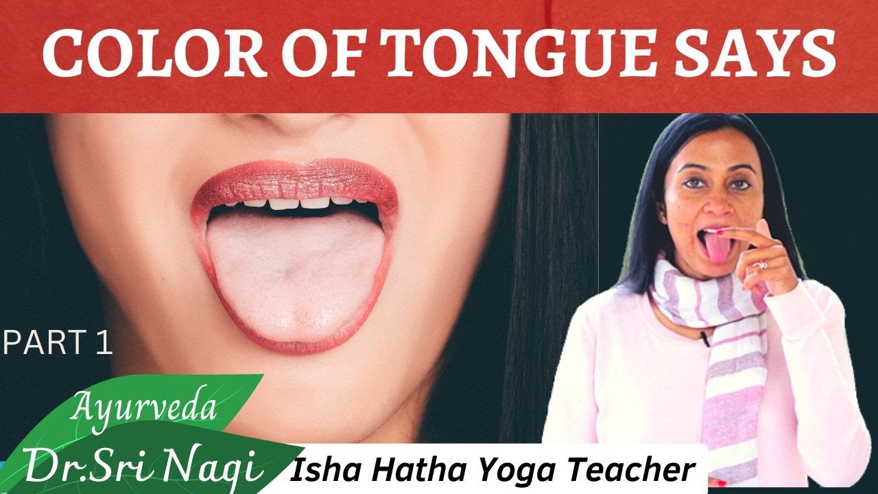 Tongue examination 🤔 Right way tongue examination according to Ayurveda ...