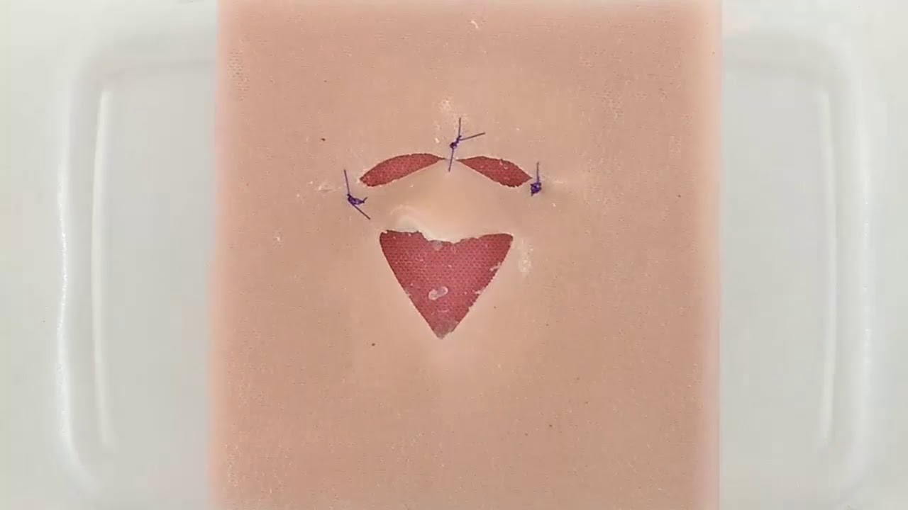 V-Y plasty training - Myocutaneous simulator for teaching suture and ...