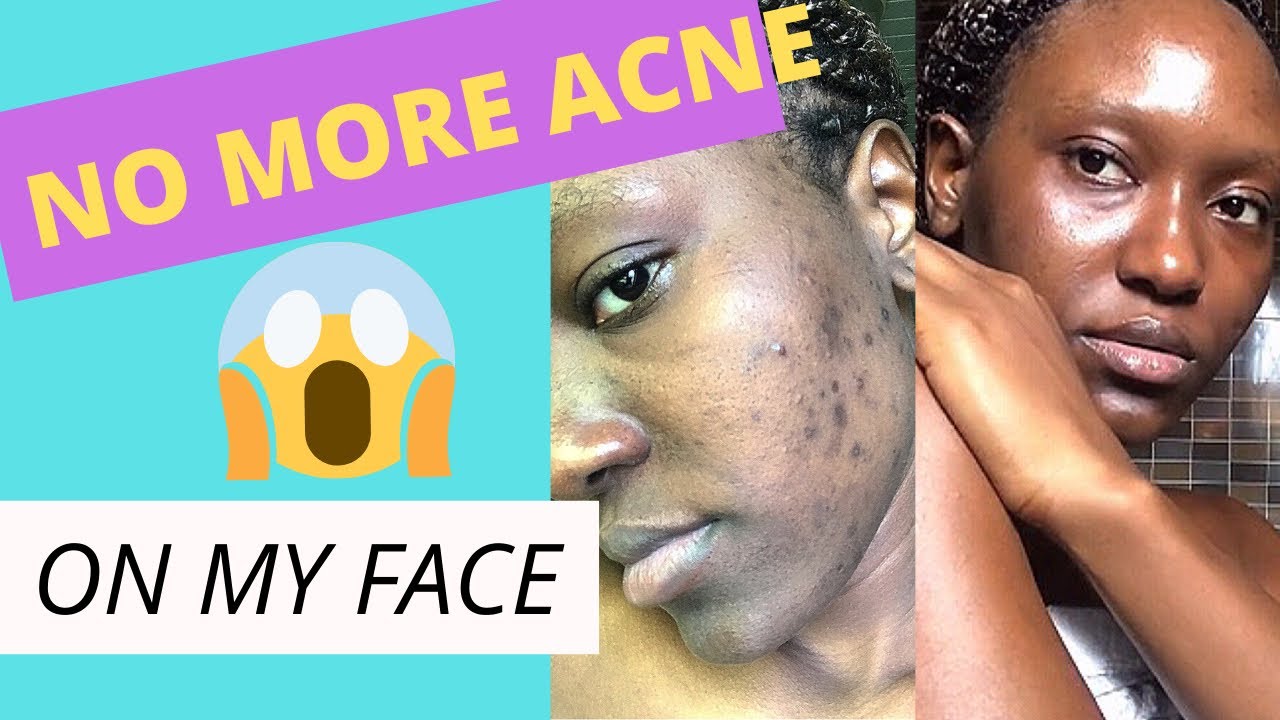 MY FACIAL SKINCARE ROUTINE | HOW I FADED MY ACNE - YouTube