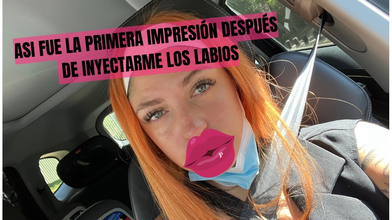 me inyecte LABIOS y NO quería salir del lugar por como QUEDE 😱 - Vlog ...
