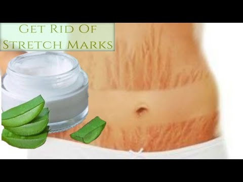 How to reduce stretch marks using natural ingredients||fast stretch ...