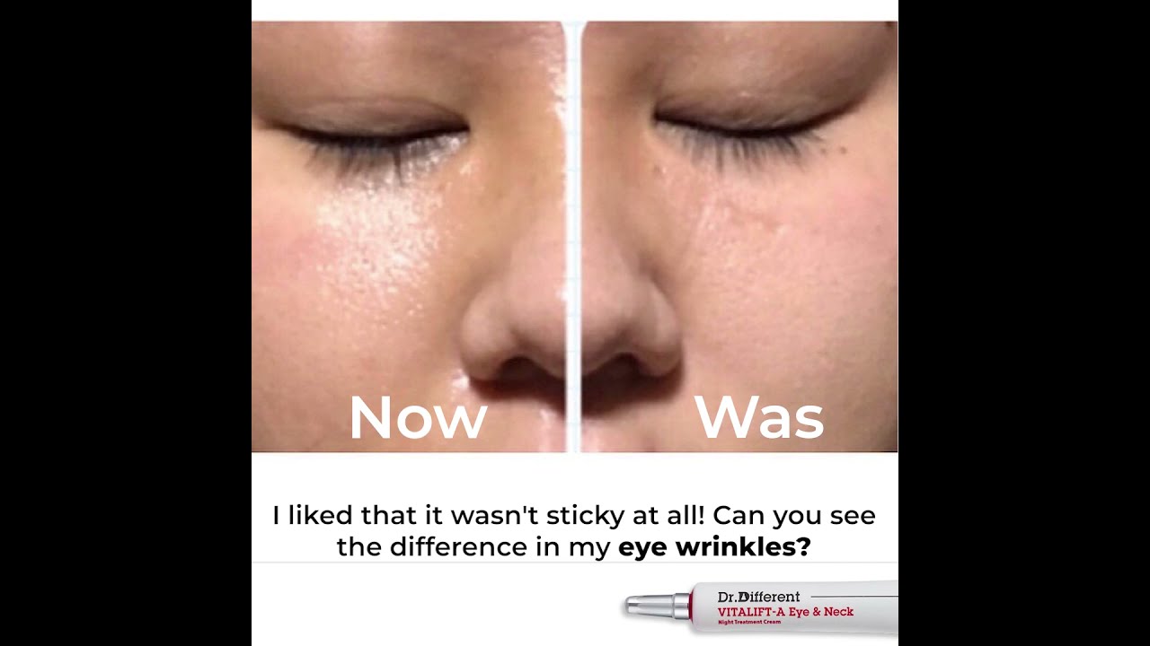 Dr diff reviews - YouTube