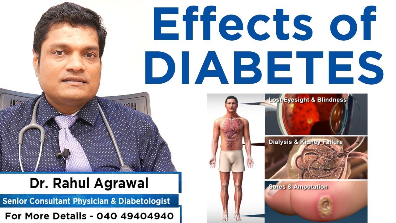 Effects of diabetes on the body and organs | Effects of Diabetes | How ...