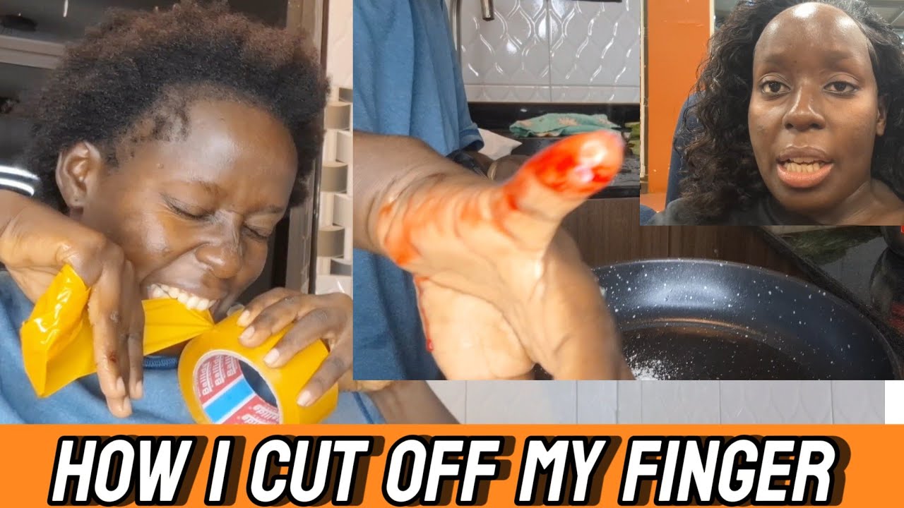How I Nearly Lost Finger trying To Cook At Night - YouTube