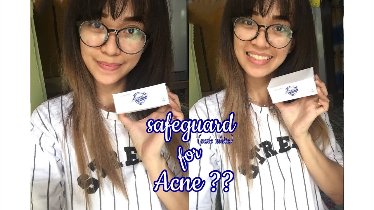 HOW SAFEGUARD (PURE WHiTE) HELP’S REMOVE MY ACNE ️ - YouTube