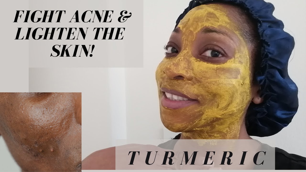 BRIGHTENING TURMERIC FACE MASK | REMOVE HYPERPIGMENTATION - FLAWLESS ...