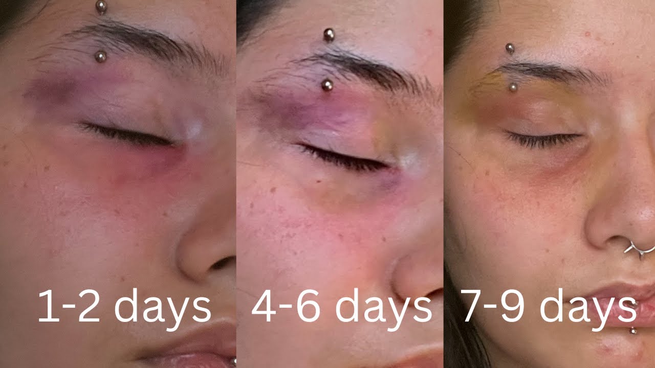 FAKE BRUISE TUTORIAL SFX - YouTube