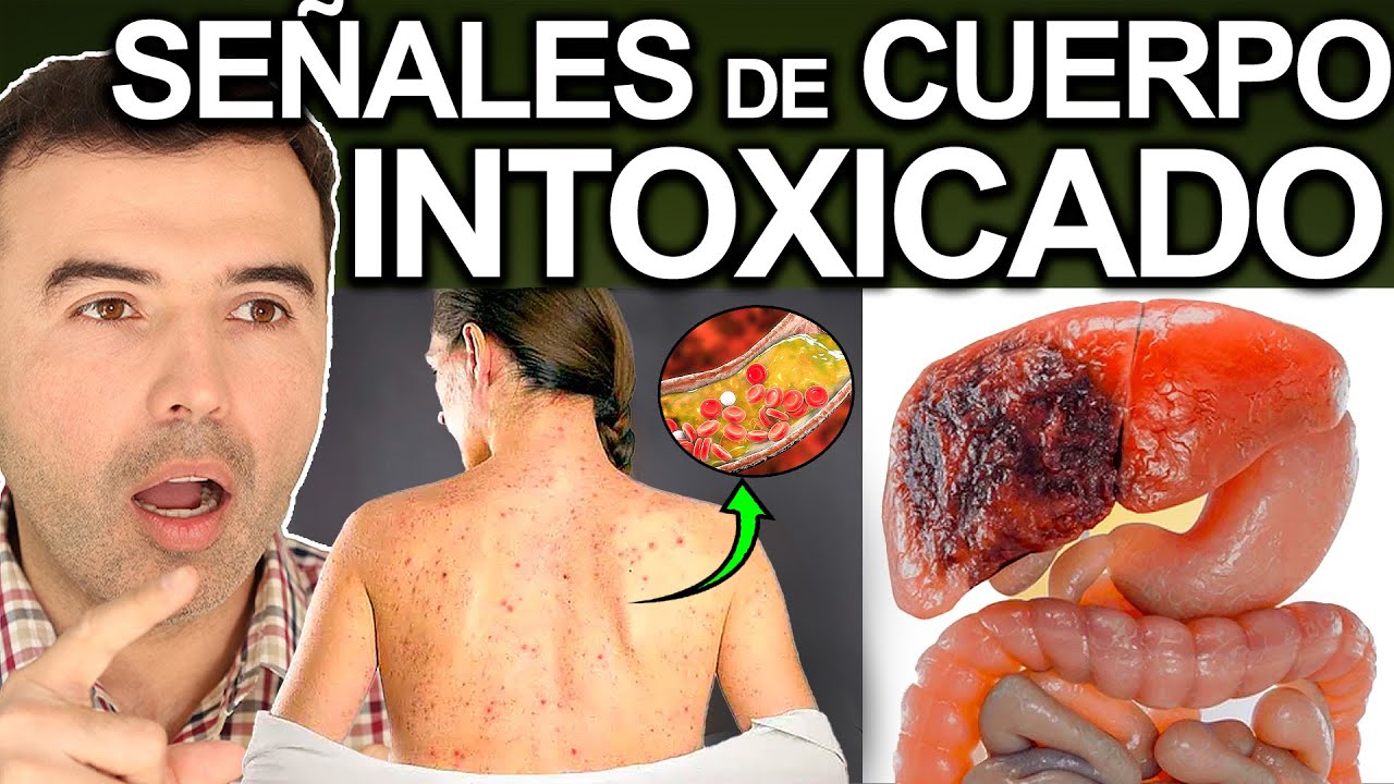 ¡PELIGRO ESTÁS INTOXICADO! Signos Y Síntomas Que Indican Toxinas En Tu ...