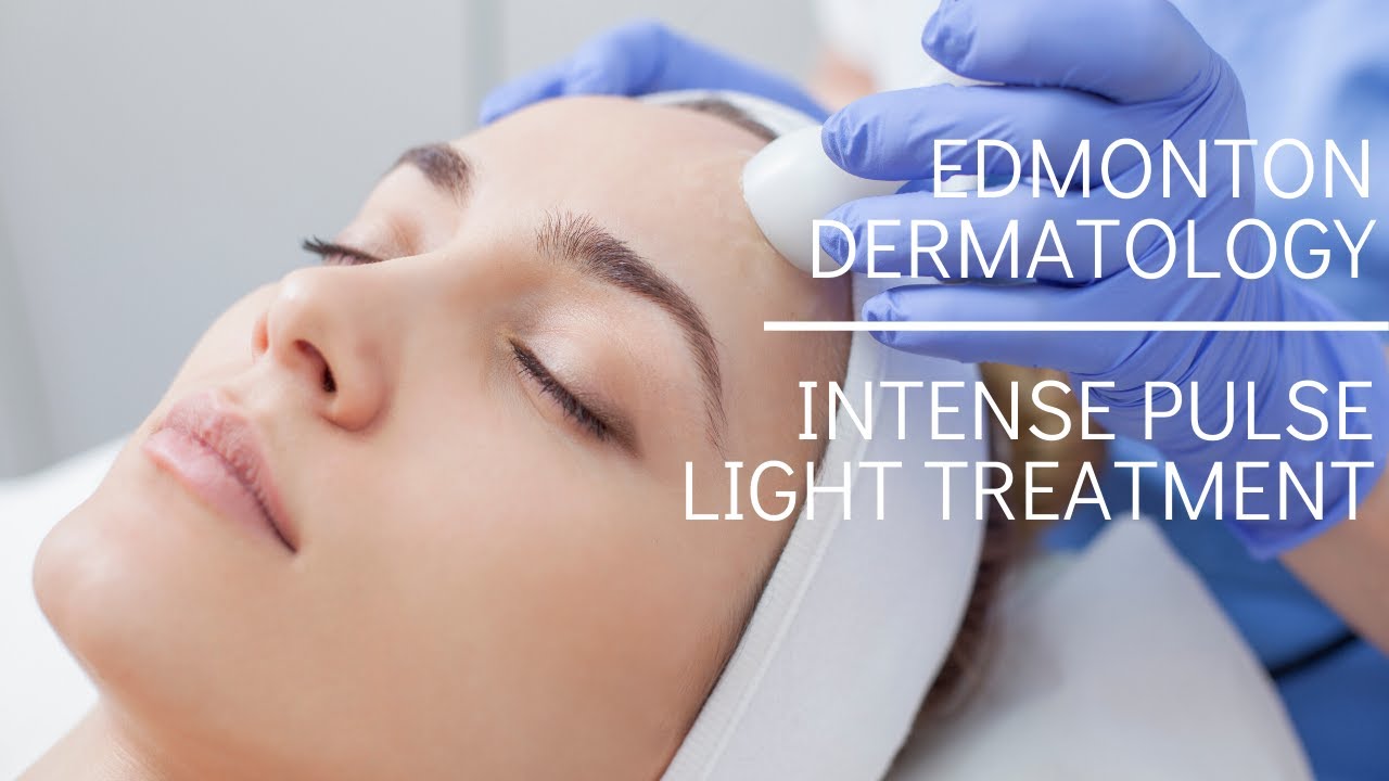 Edmonton Dermatology Intense Pulse Light Treatment - YouTube
