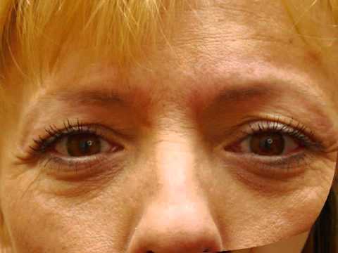 Ditto Aesthetics - YouTube