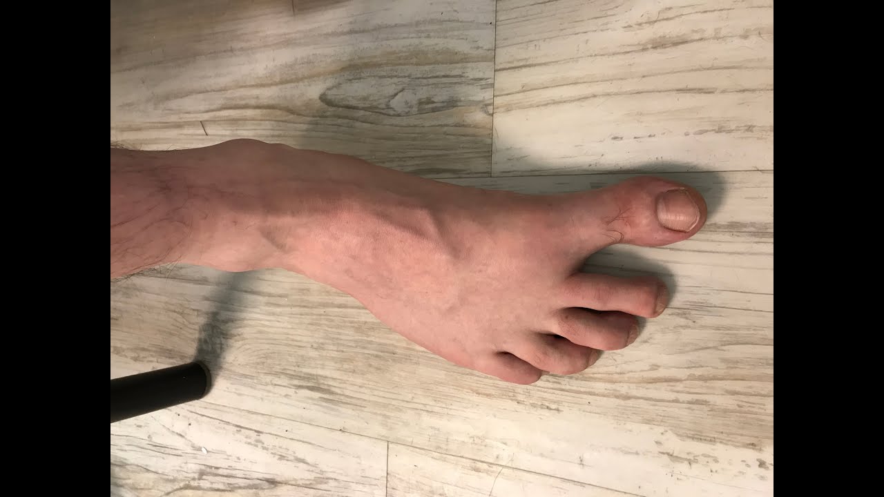 Opposable Big Toe - YouTube