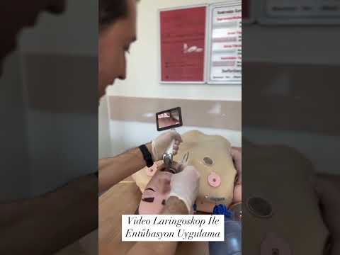 Video Laringoskop İle Entübasyon Uygulaması