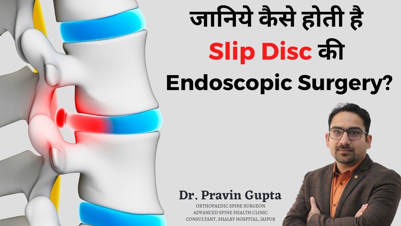 जानिये कैसे होती है Slip Disc की Endoscopic Surgery? | Endoscopic ...