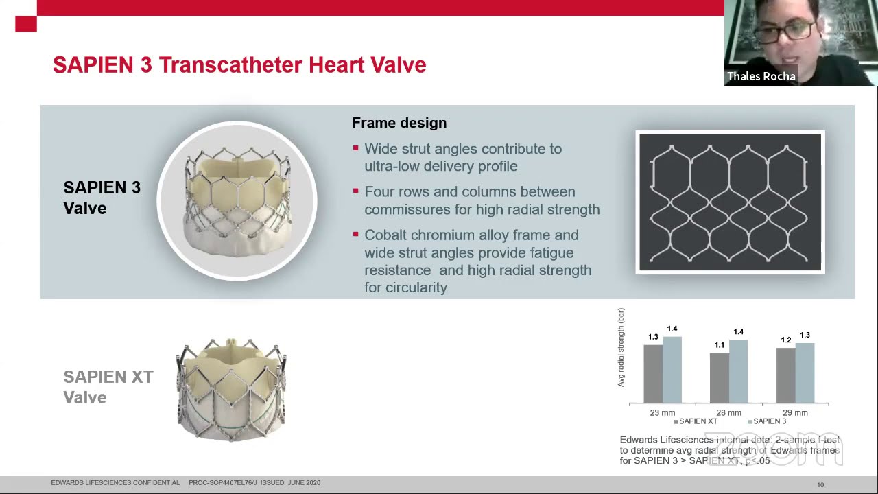 Curso Sapien 3 (Aula 2) - Planejando uma TAVI de Sucesso - Edwards- Dr ...