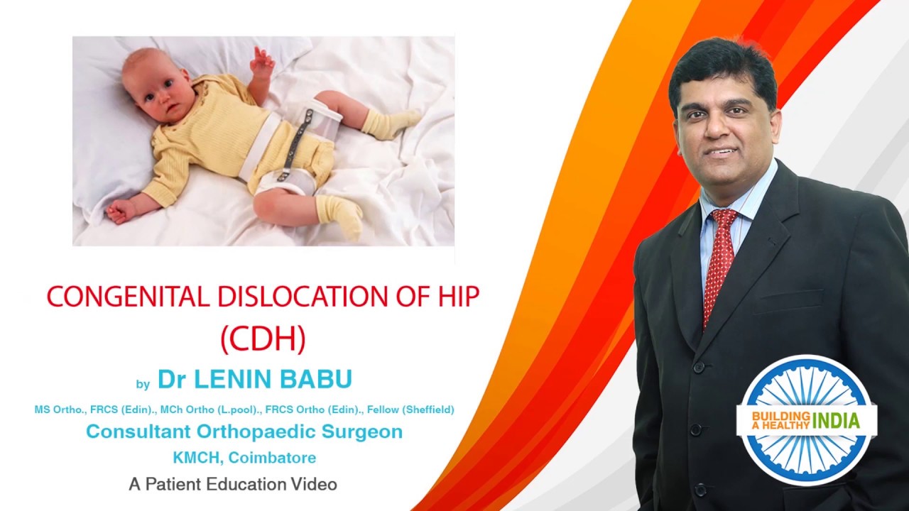 #Congenital Dislocation of Hip(CDH=DDH)Dr Lenin Babu#Paediatric ...
