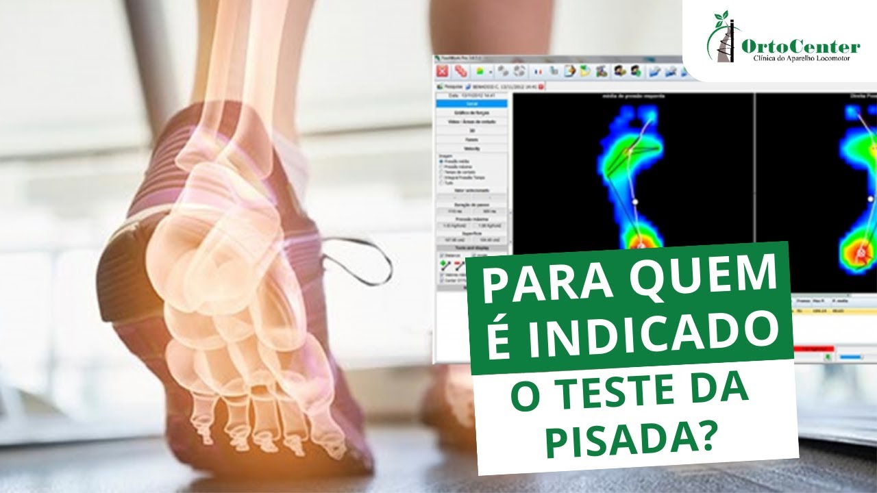 Para quem é indicado o teste da pisada? | Dr. Philippe Carvalho e Mária ...