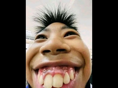 When Skill Issues Hit Hard 😂| part 1 - YouTube