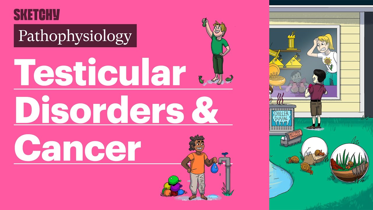 Testicular Disorders & Cancer (Pathophysiology) | Sketchy Medical - YouTube