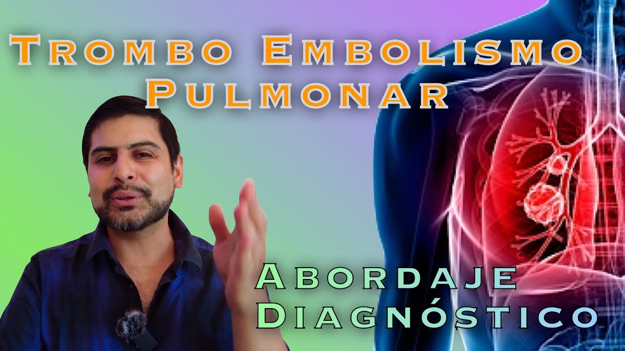 Tromboembolismo Pulmonar (TEP), Wells, PERC y Dímero D - YouTube