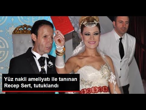 Yüz Nakli Ameliyatıyla Tanınan Recep Sert, Bin 500 Lira Borcunu Ödemeyince Tutuklandı