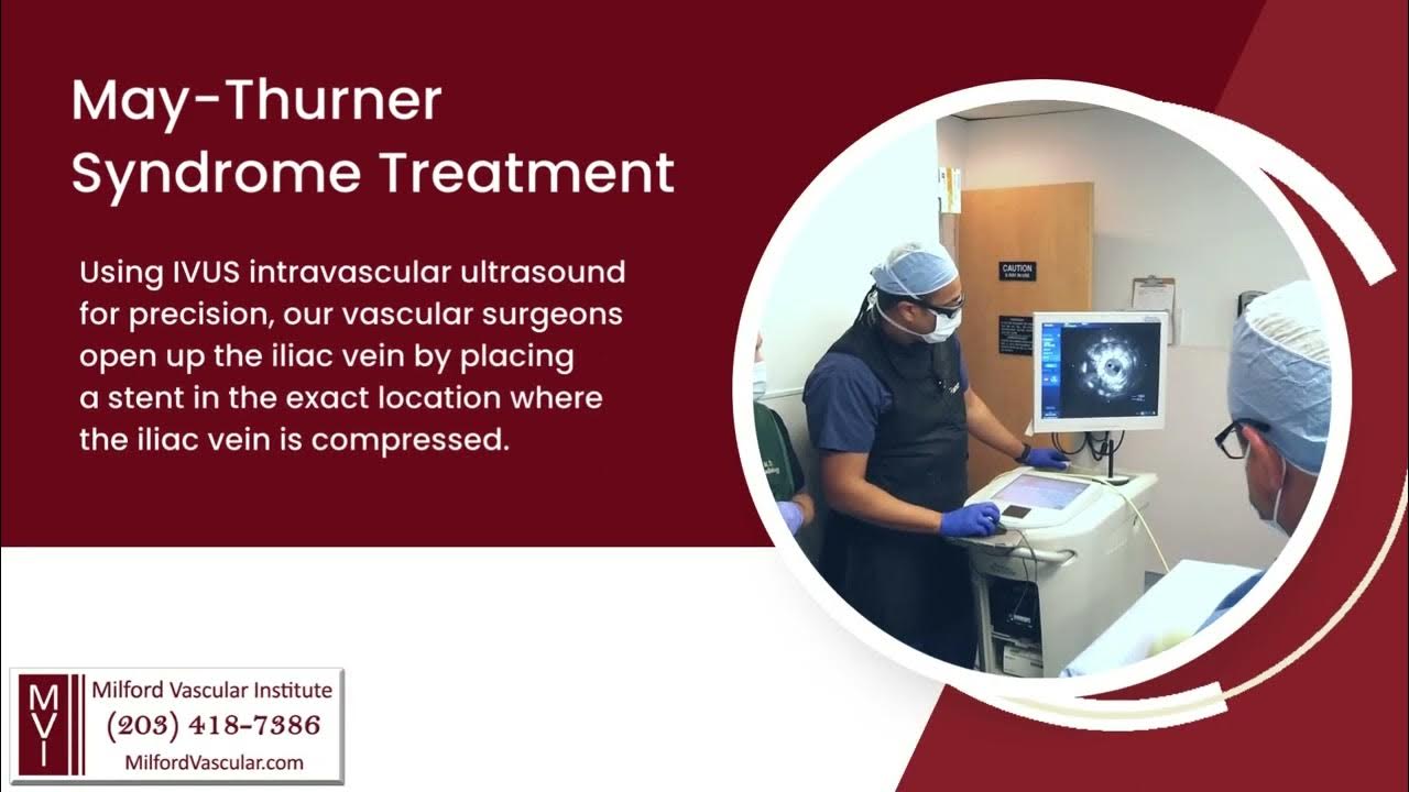 May Thurner Syndrome Ultrasound New Haven Ct What Is May Thurner