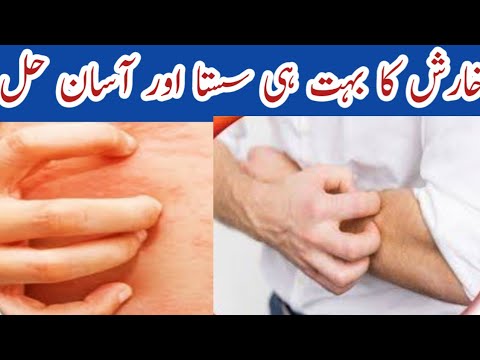 How to Control the Itch ||Kharish Kaisay Khatam Karain || Kharish Ka ...