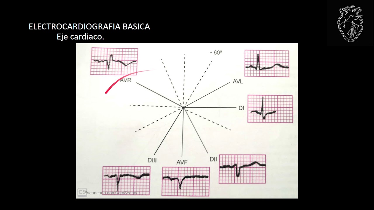 Cómo calcular el eje cardiaco. En solo 10 minutos - YouTube