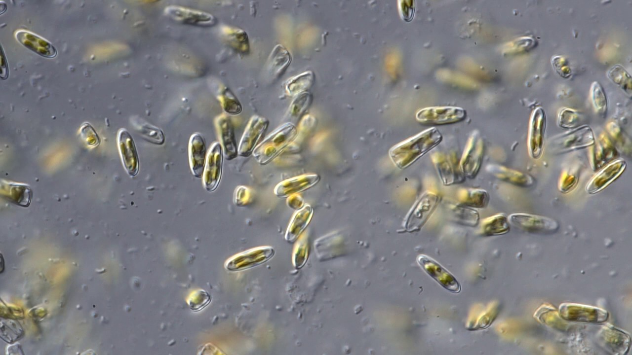Diatoms live culture - YouTube