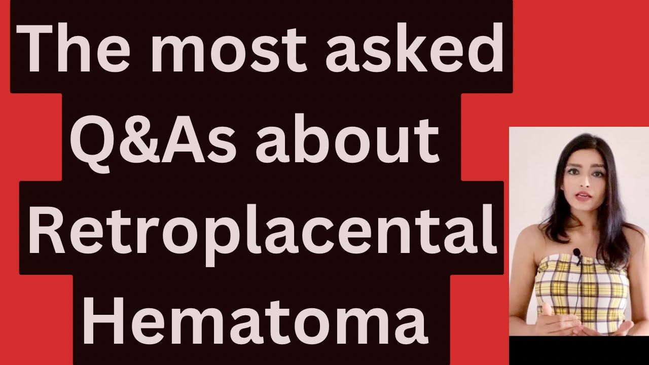 Retroplacental Hematoma: Unveiling Causes Symptoms and Treatment - YouTube