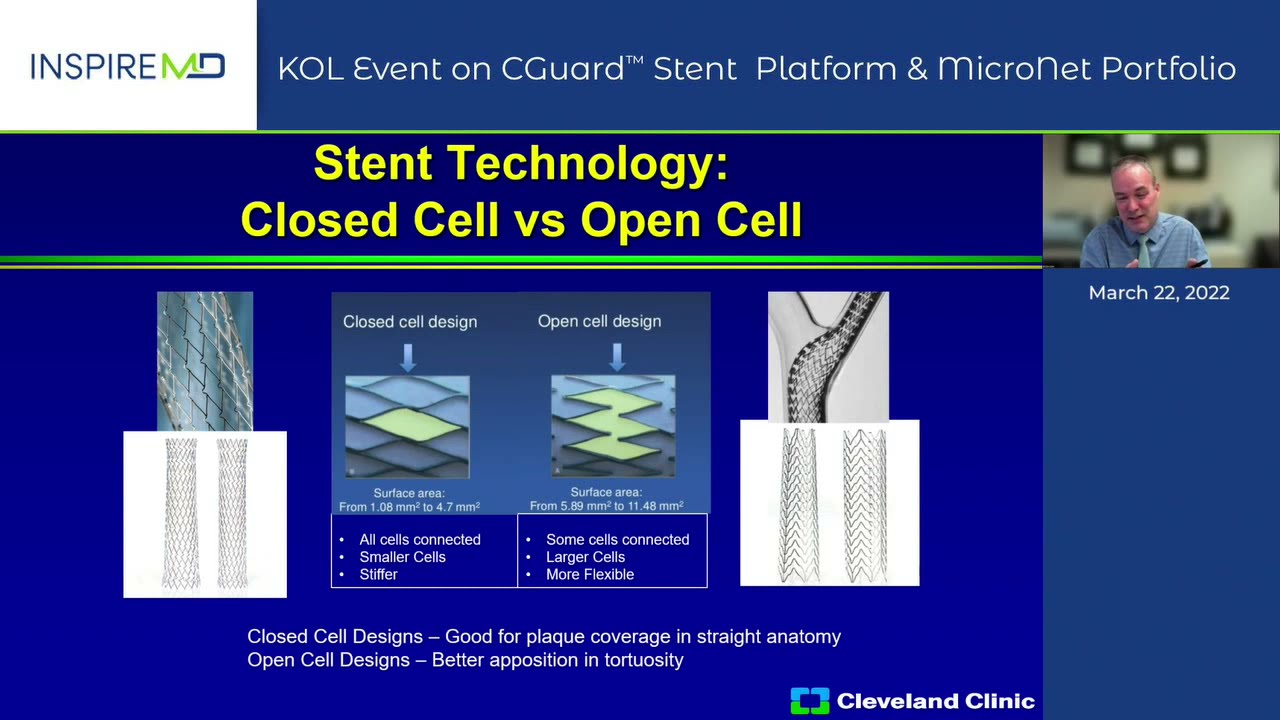 InspireMD KOL Webinar - Dr. Sean P. Lyden - YouTube