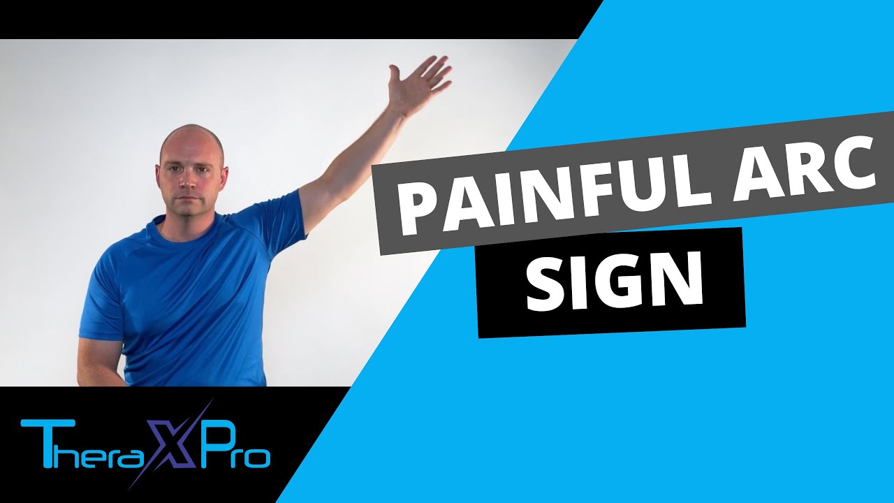 Painful Arc | Subacromial Pain Syndrome (SAPS) - YouTube
