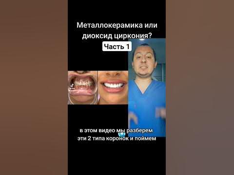 Керамика vs Цирконий Ч.1 #стоматолог #стоматология #циркон #цирконий # ...