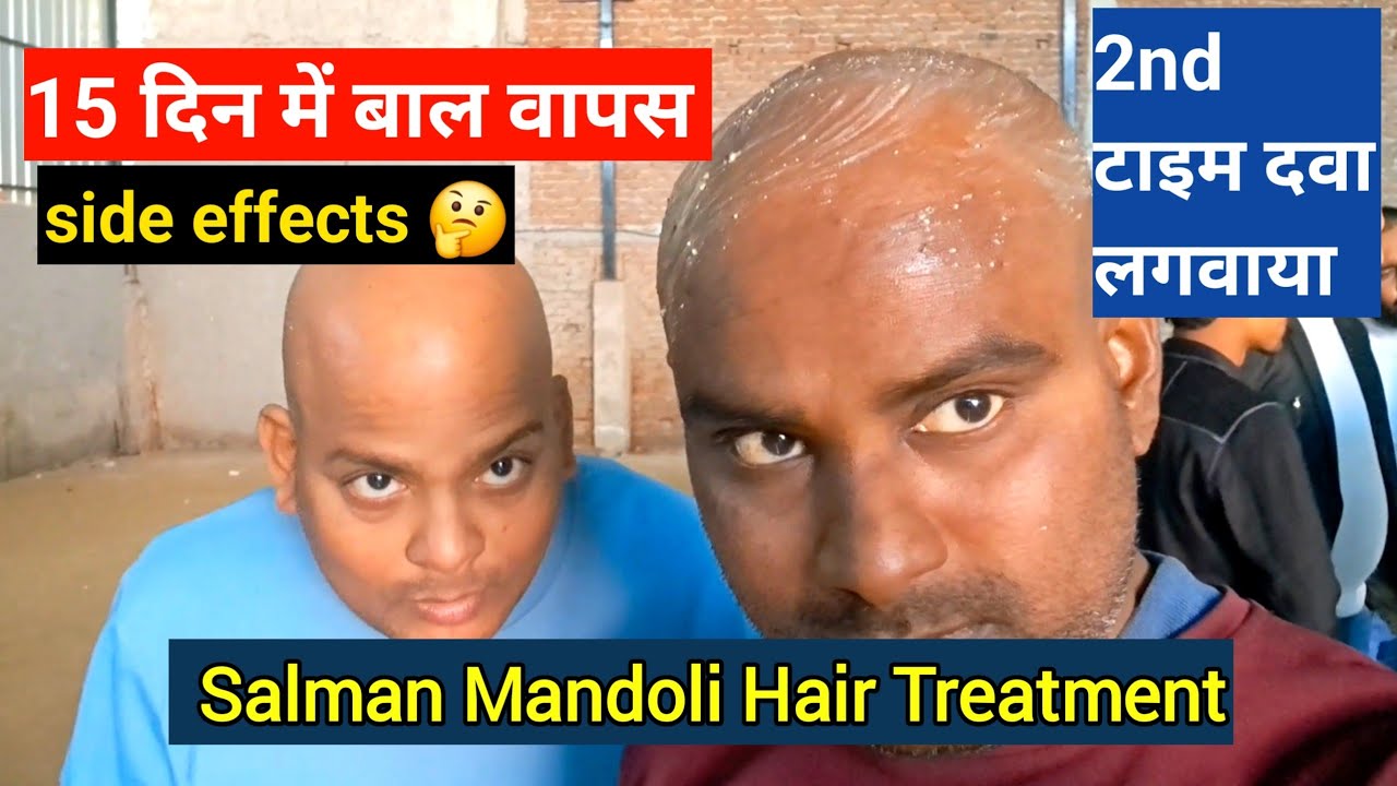 Salman mandoli hair treatment | Salman mandoli location | Salman hair ...