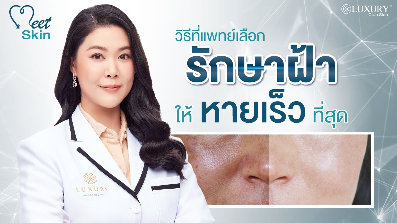 รักษาฝ้าอย่างไร ให้หายไวที่สุด วิธีนี้ที่เเพทย์เลือก : Meet Skin - YouTube